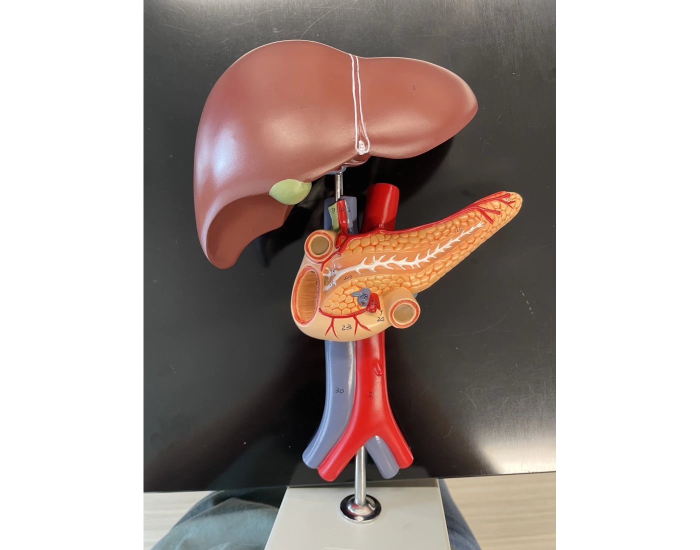 Liver Pancreas And Duodenum Model Ant View Quiz