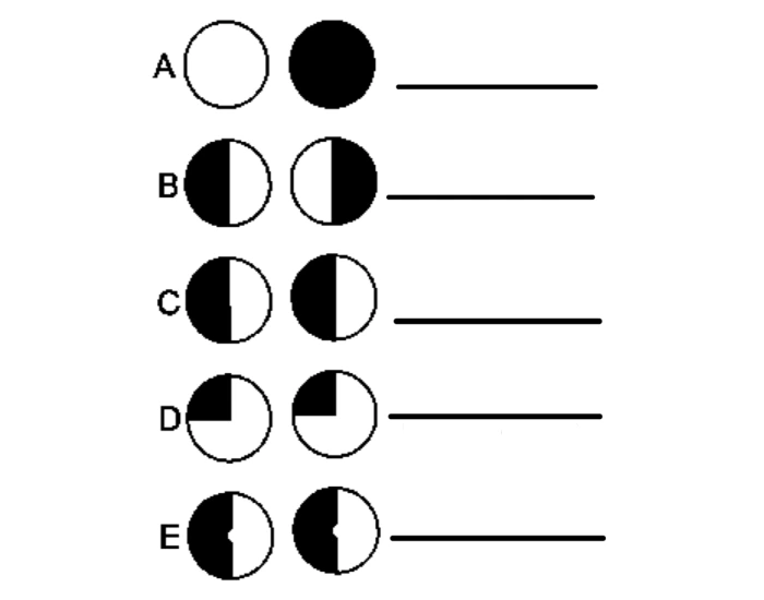 Ocular Pathway Lesion Names Quiz ocular-pathway-lesion-names-quiz