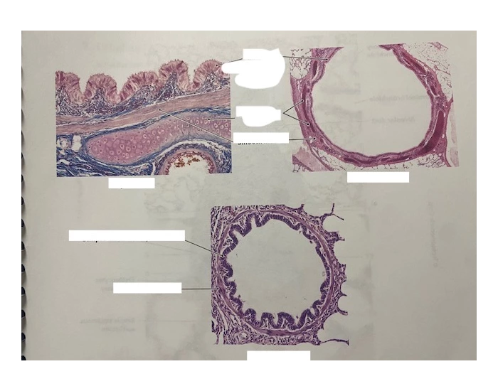 Bronchusbronchiole Cross Section Quiz