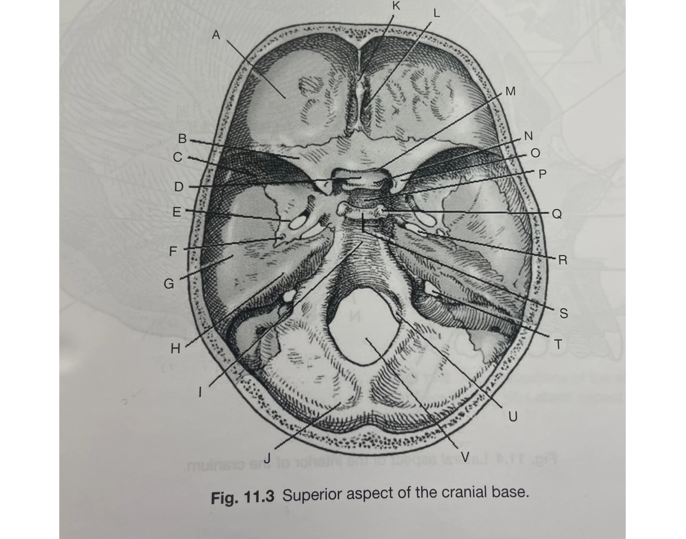 Skull Base Anatomy Quiz