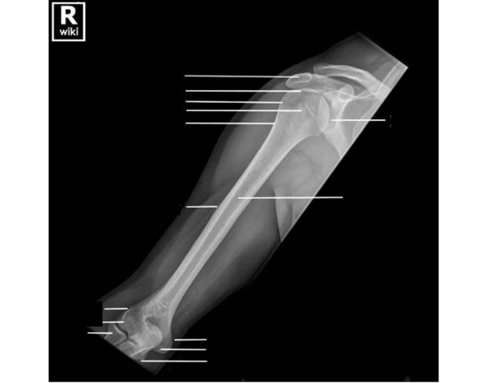 Humerus Quiz humerus-quiz