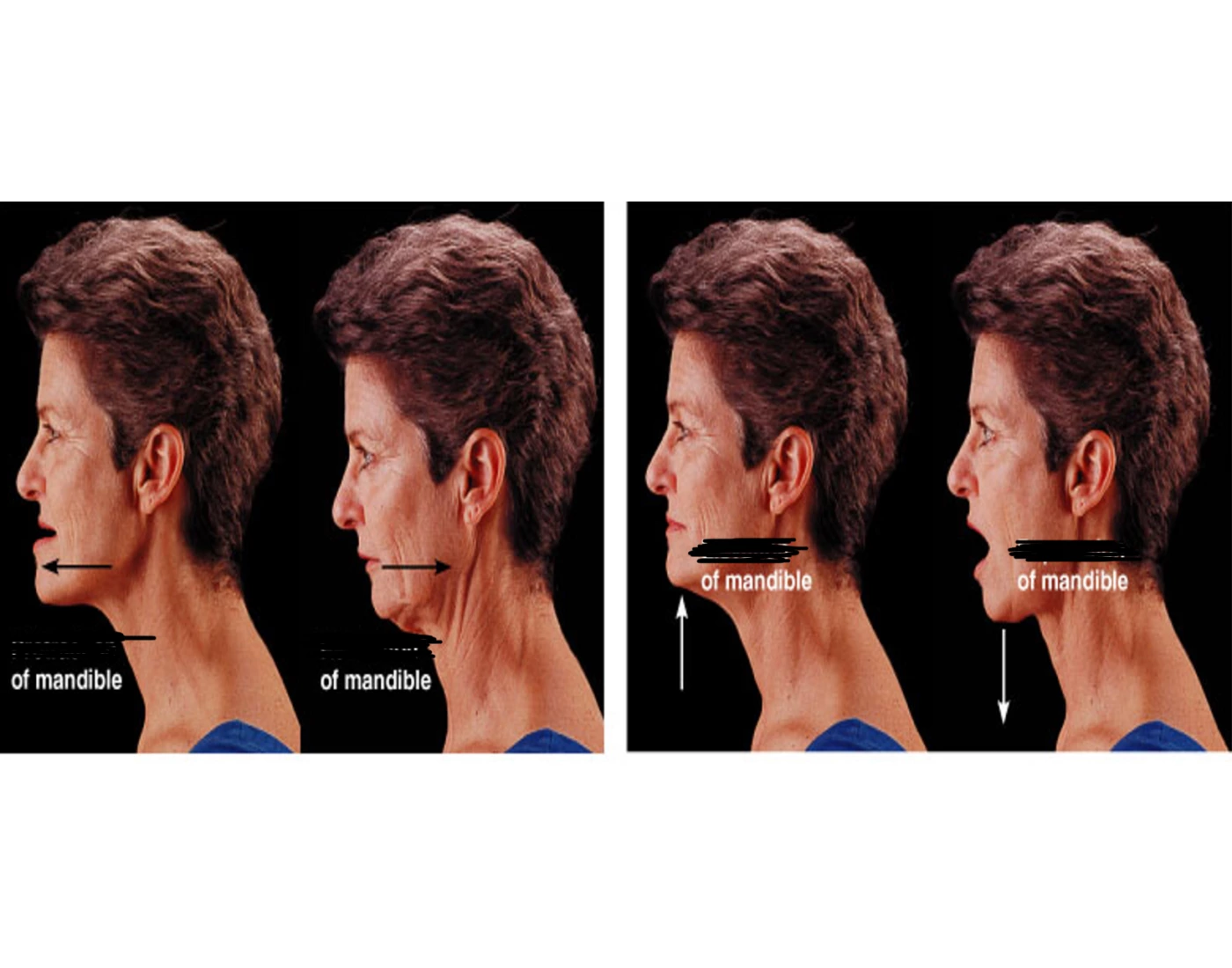 Motion Of Synovial Joint Cont Quiz