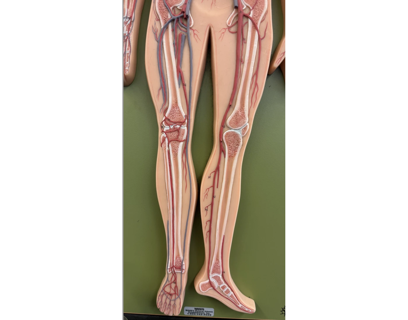 Pulmonary System Lower Quiz