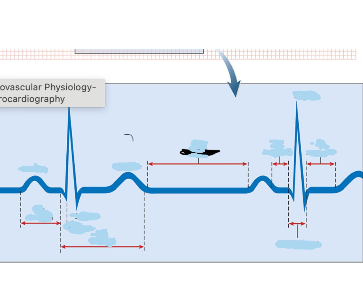 ECG label — Printable Worksheet ECG label — Printable Worksheet