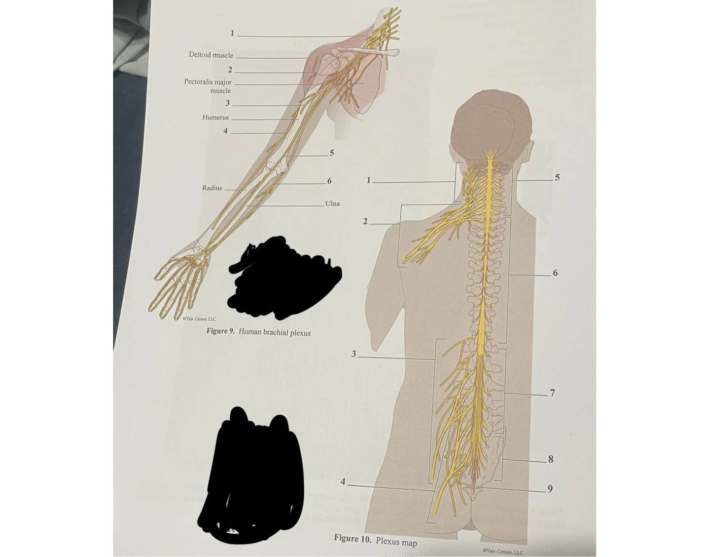 Plexus Map Arm Section Quiz
