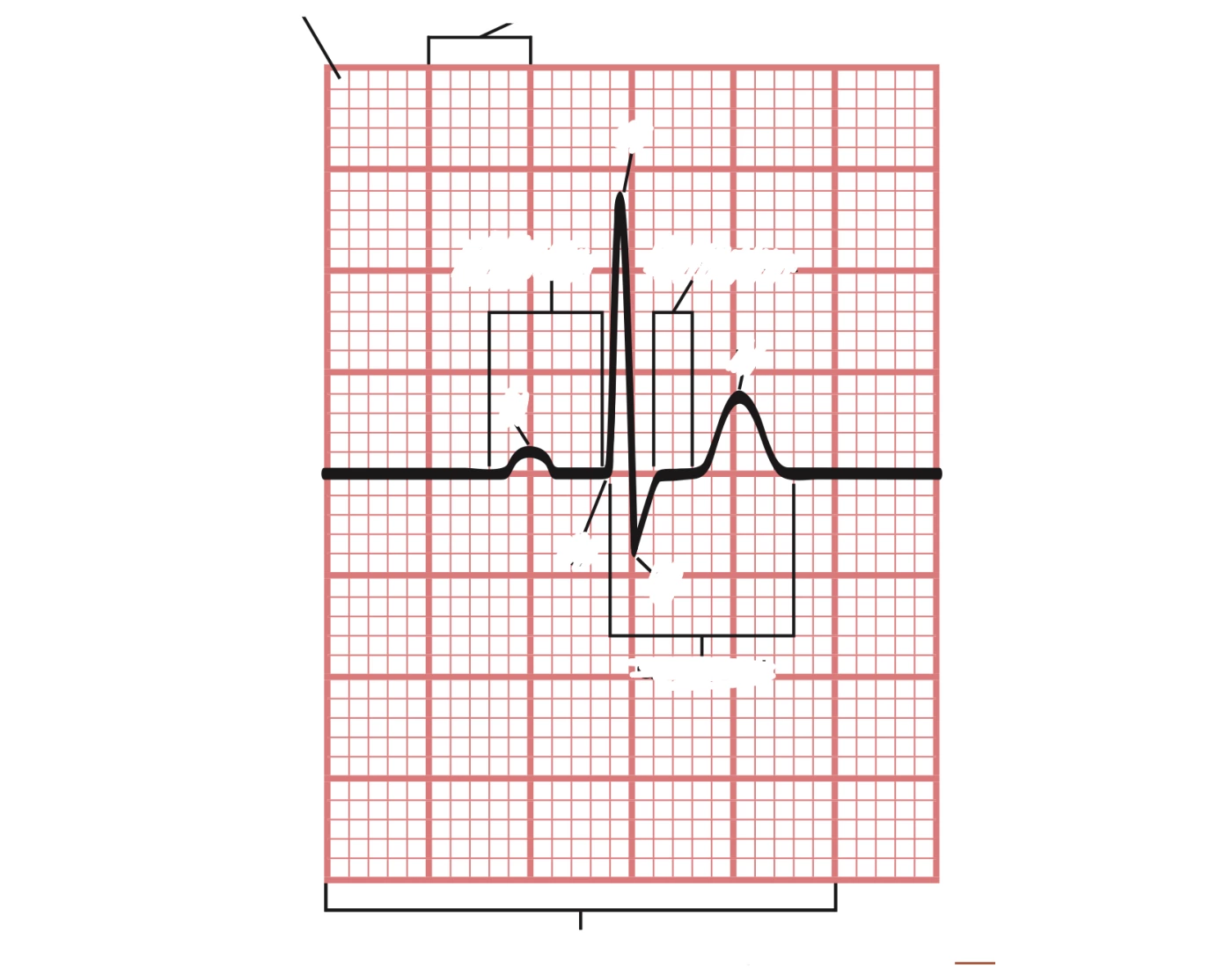 ECG Labeling Lab Manual — Printable Worksheet ECG Labeling Lab Manual — Printable Worksheet