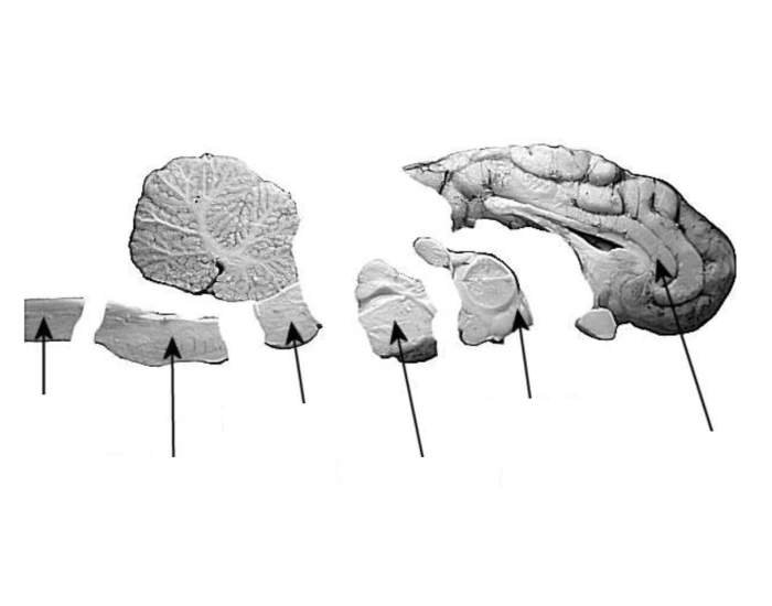 The Major Divisions Of The Brain Sagittal View Quiz