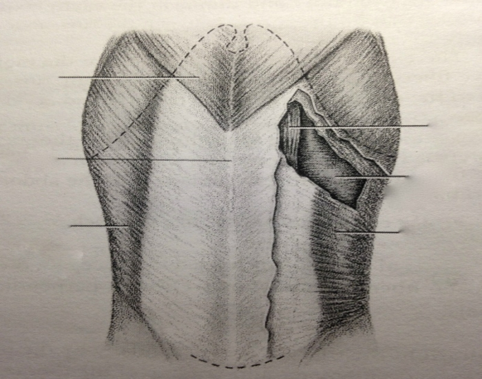 Muscles Of The Trunk Quiz