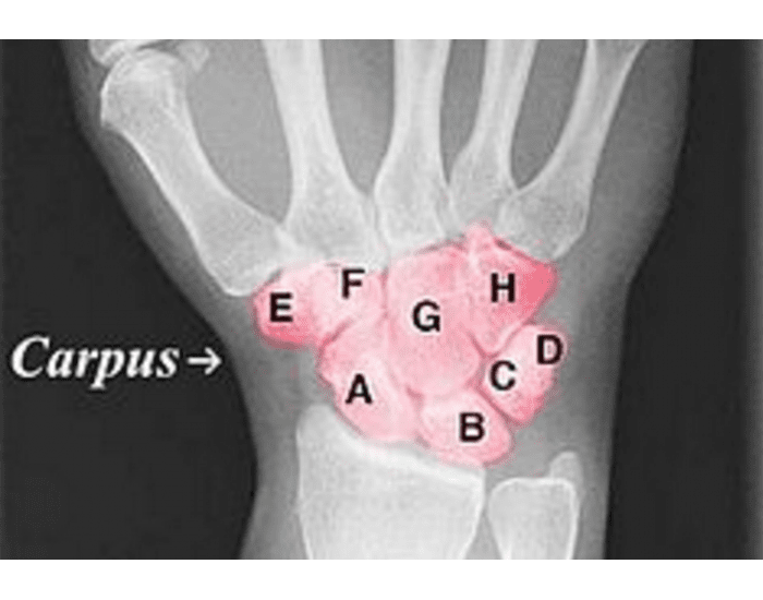 Carpal Bone Labeling Quiz carpal-bone-labeling-quiz