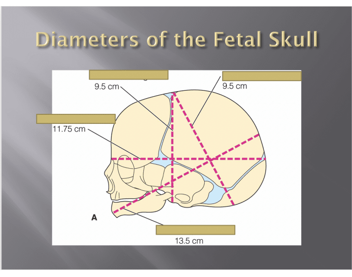 Diameters Of Fetal Skull Quiz diameters-of-fetal-skull-quiz