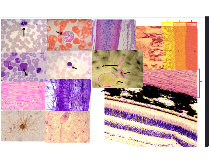 Histology Photomicrographs 2 Quiz Histology Photomicrographs 2 Quiz
