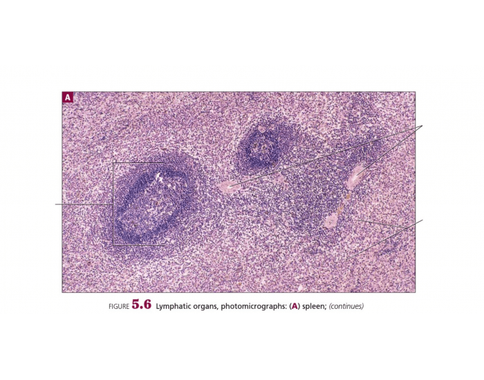 Lymphatic organs, photomicrographs Quiz Lymphatic organs, photomicrographs Quiz