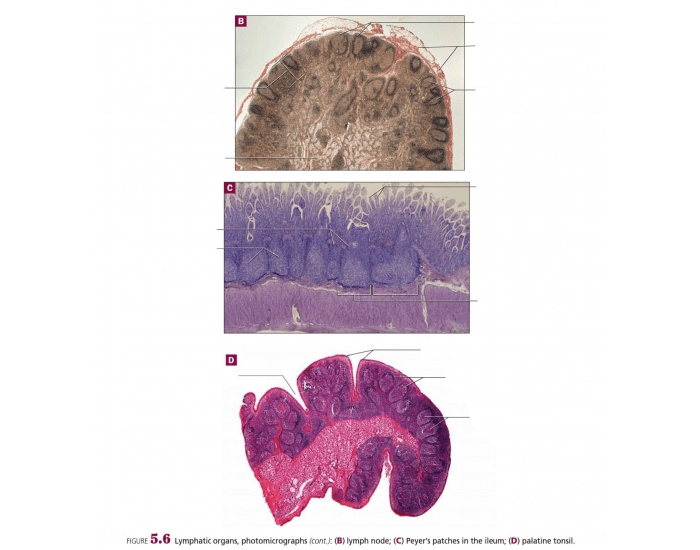 Lymphatic organs, photomicrographs Quiz Lymphatic organs, photomicrographs Quiz