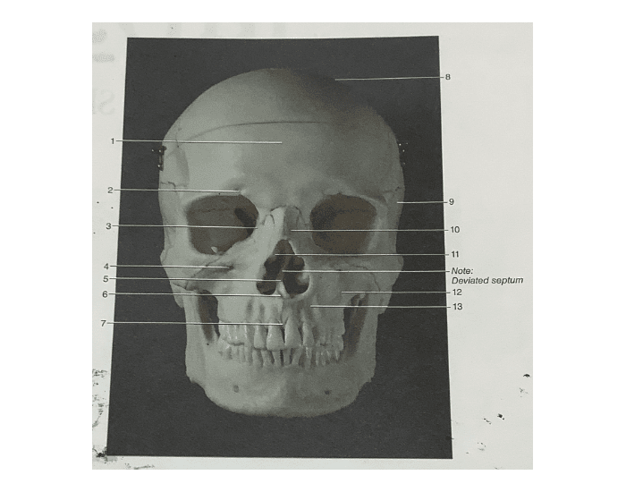 Skull Bones Quiz skull-bones-quiz