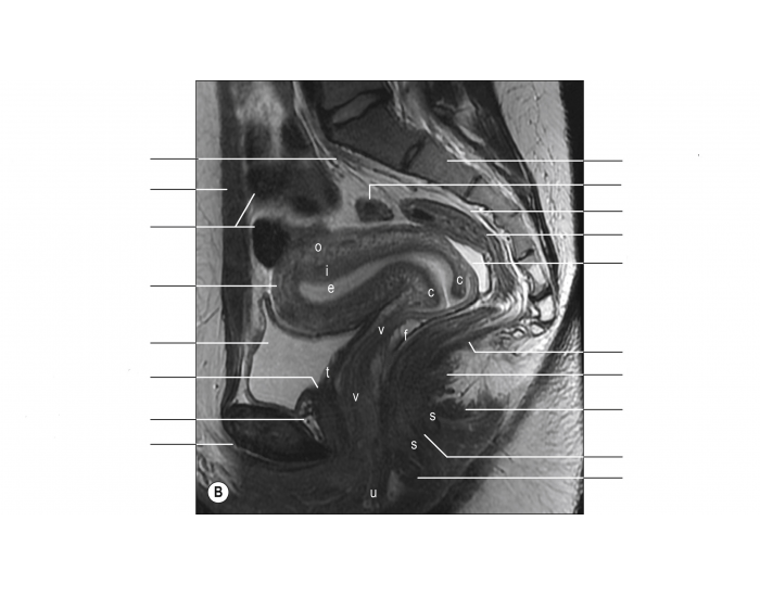 Sagittal Section Female Pelvis Quiz