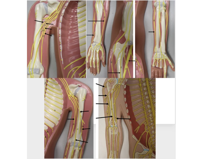 Nervous System Flat Board Model - Upper Limbs Quiz Nervous System Flat Board Model - Upper Limbs Quiz