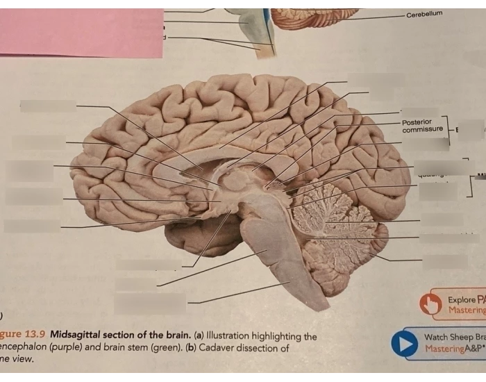 Figure 17.4 Diencephalon and brain stem structures Quiz Figure 17.4 Diencephalon and brain stem structures Quiz