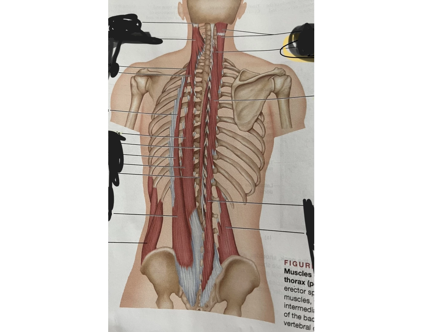 Posterior Muscles Of Human Trunk Quiz