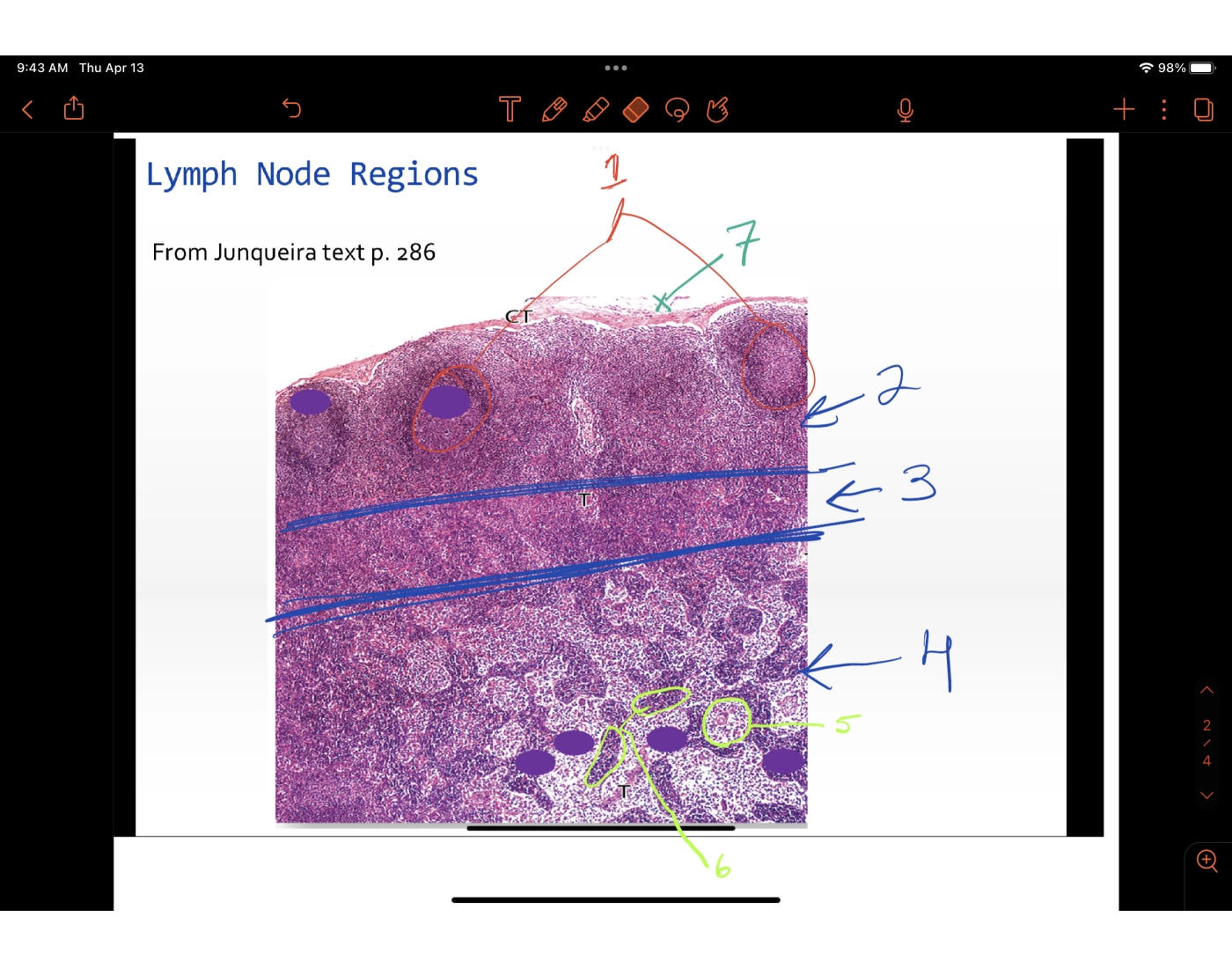 Lymph Node Region (Palmer) Quiz Lymph Node Region (Palmer) Quiz