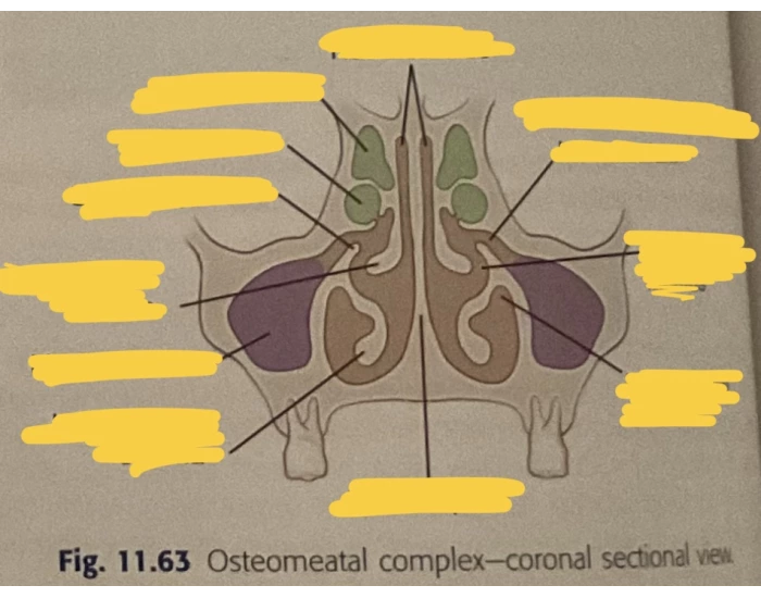 Osteomeatal Complex Coronal Sectional View Quiz osteomeatal-complex-coronal-sectional-view-quiz