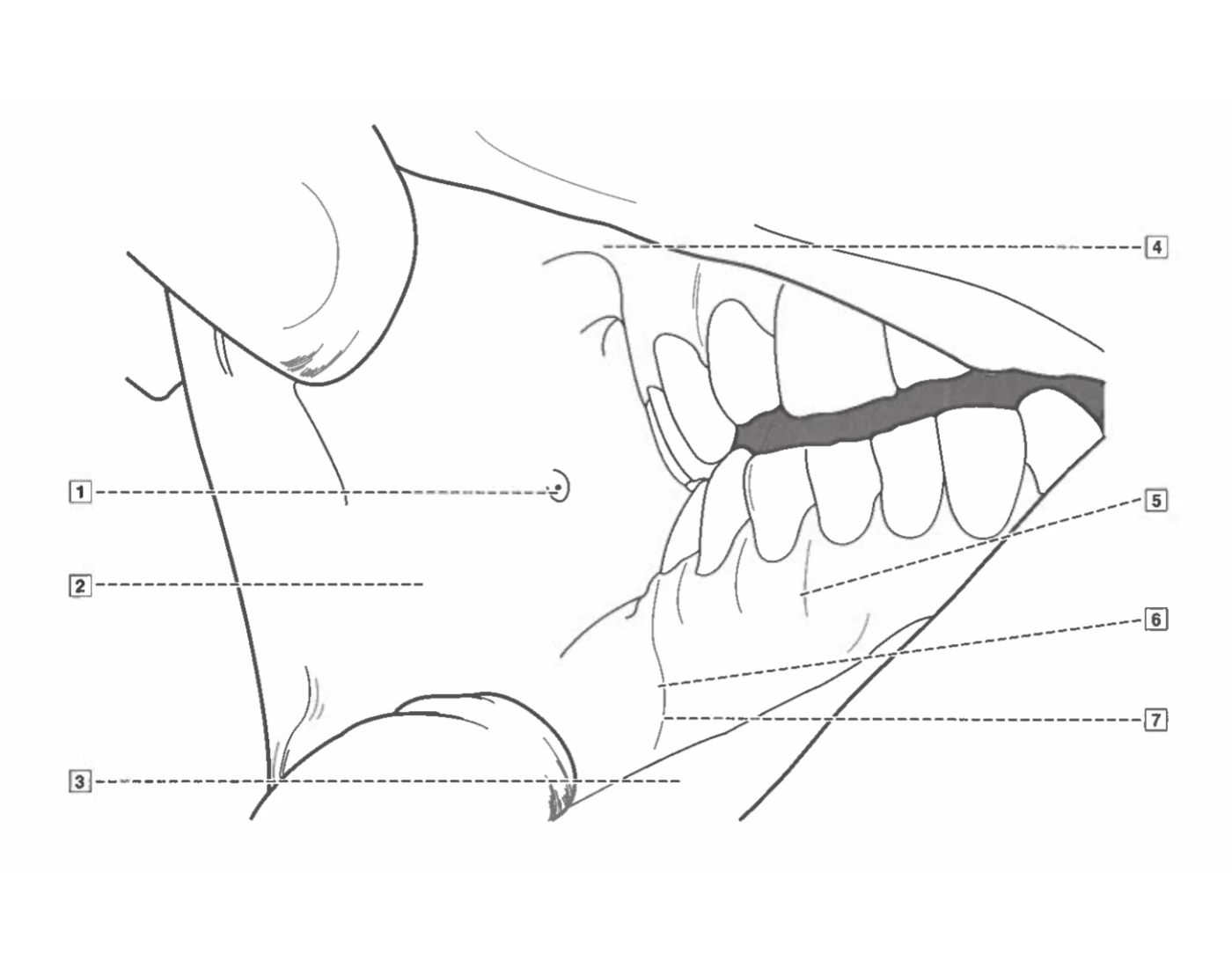 Oral Region Oral Mucosa Lateral View Quiz