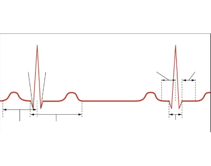 Ecg Graph Quiz