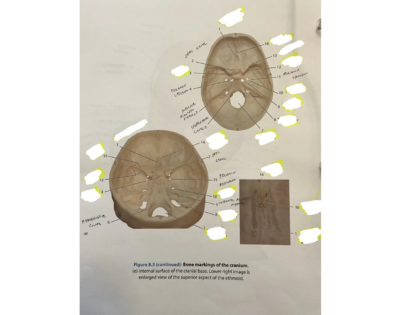 Bone Markings of the Cranium Quiz Bone Markings of the Cranium Quiz