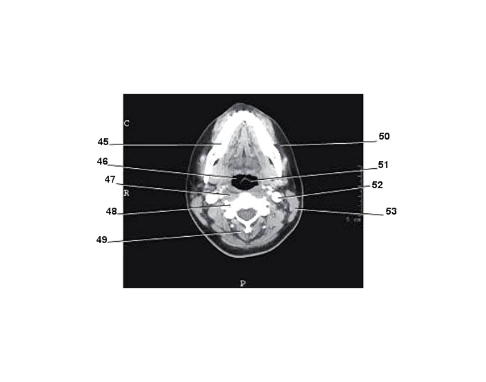 Neck Ct Anatomy Quiz