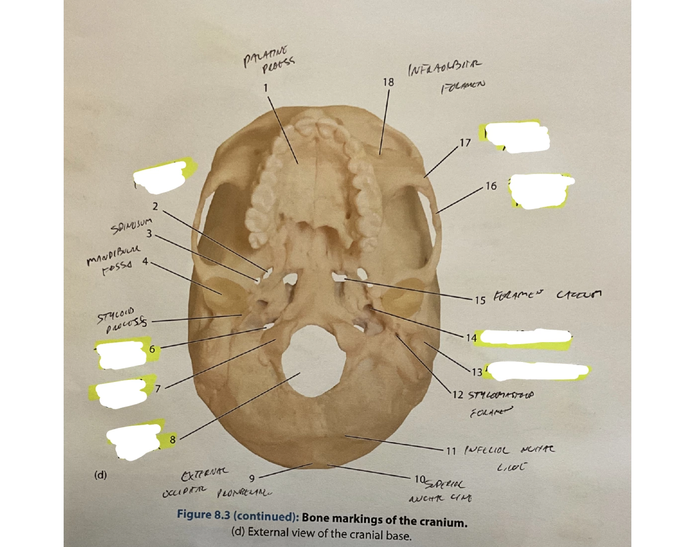 Bone Markings of the Cranium, External View Quiz Bone Markings of the Cranium, External View Quiz