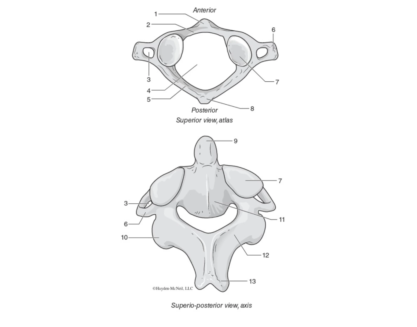 Labeling Axis And Atlas Vertebrae Quiz labeling-axis-and-atlas-vertebrae-quiz